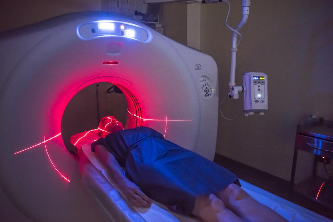 Mark’s PET Imaging Story | Right Scan Right Time